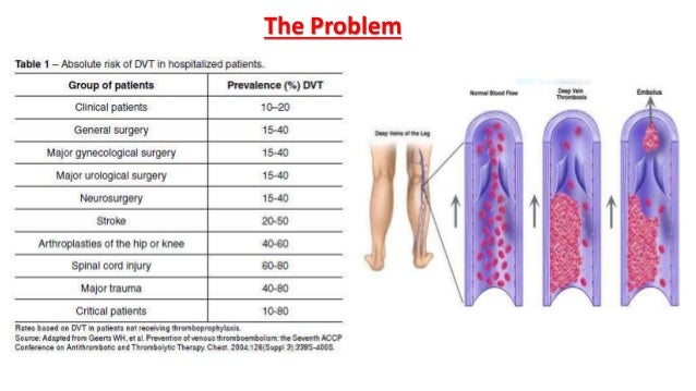 DVT PROPHYLAXIS IN ORTHOPAEDICS