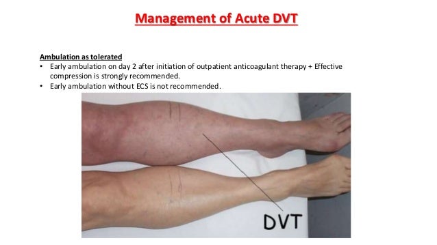 DVT PROPHYLAXIS IN ORTHOPAEDICS