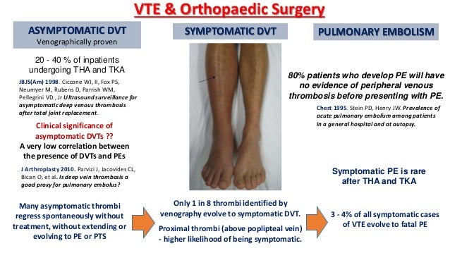 DVT PROPHYLAXIS IN ORTHOPAEDICS
