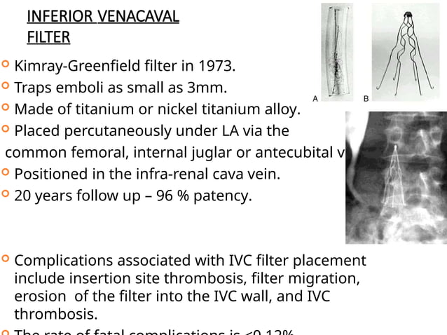dvt presentation in orthopaedics pov.pptx