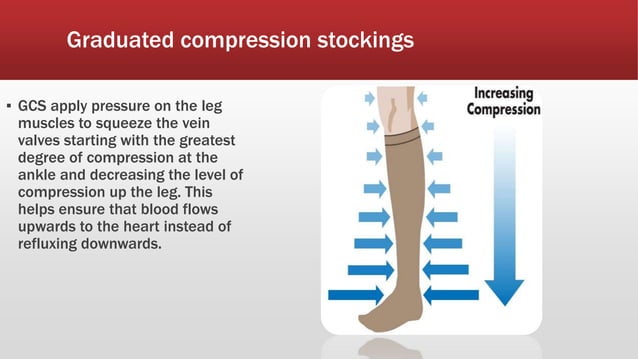DVT prophylaxis.pptx | Blood Disorders | Diseases and Conditions