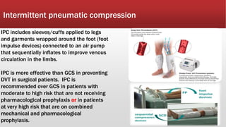 DVT prophylaxis.pptx