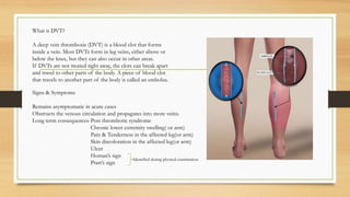 DVT PROPHYLAXIS FOR SURGERIES-dona.pptx