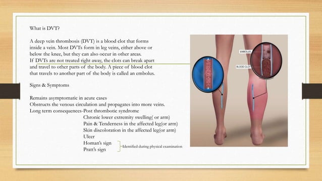 DVT PROPHYLAXIS FOR SURGERIES-dona.pptx | Blood Disorders | Diseases ...