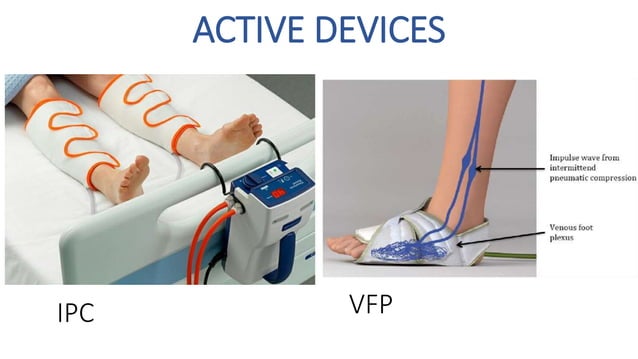 DVT Prophylaxisis in Surgery main by Dt. Kingsley Magbei.pptx