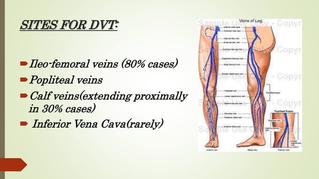Dvt prophylaxis , treatment and anaesthetic considerations | PPTX ...
