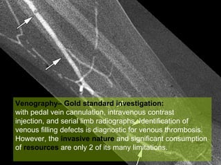 Deep venous thrombosis | PPT