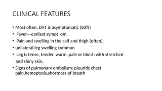 DVT-definition-clinical pictures- management | PPTX