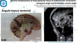 Ángulos fosa posterior | PPT