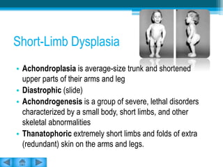 Dwarfism 120226201518-phpapp02 | PPTX