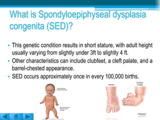 Dwarfism | PPTX