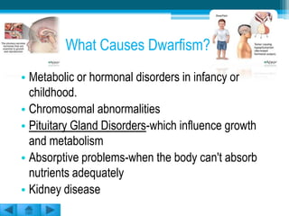 Dwarfism | PPTX