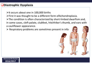 Dwarfism | PPTX