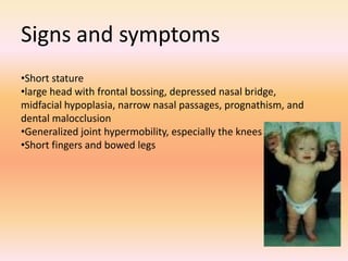 Dwarfism Biology | PPTX