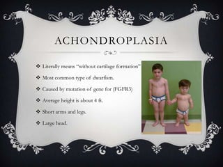 Dwarfism 2 | PPT