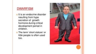 DWARFISM AND GIGANTISM .pptx