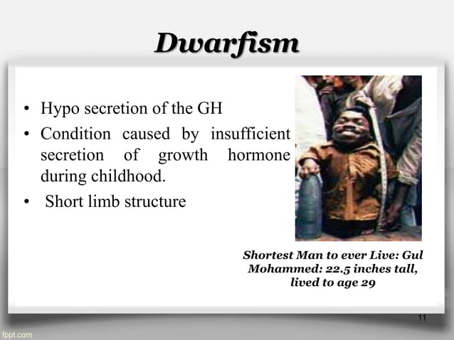 DWARFISM,GIGANTISM and sign symptoms,causes | PPT