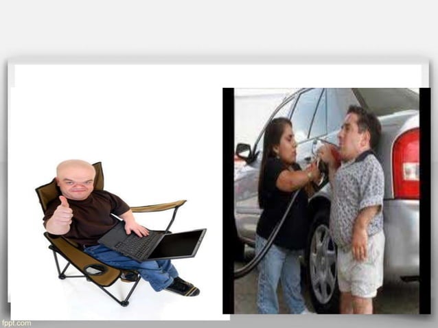 DWARFISM,GIGANTISM and sign symptoms,causes | PPT