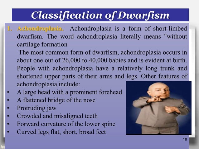 DWARFISM,GIGANTISM and sign symptoms,causes | PPT