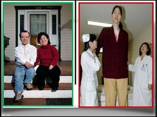 DWARFISM,GIGANTISM and sign symptoms,causes | PPTX