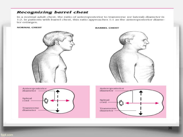 DWARFISM,GIGANTISM and sign symptoms,causes | PPT