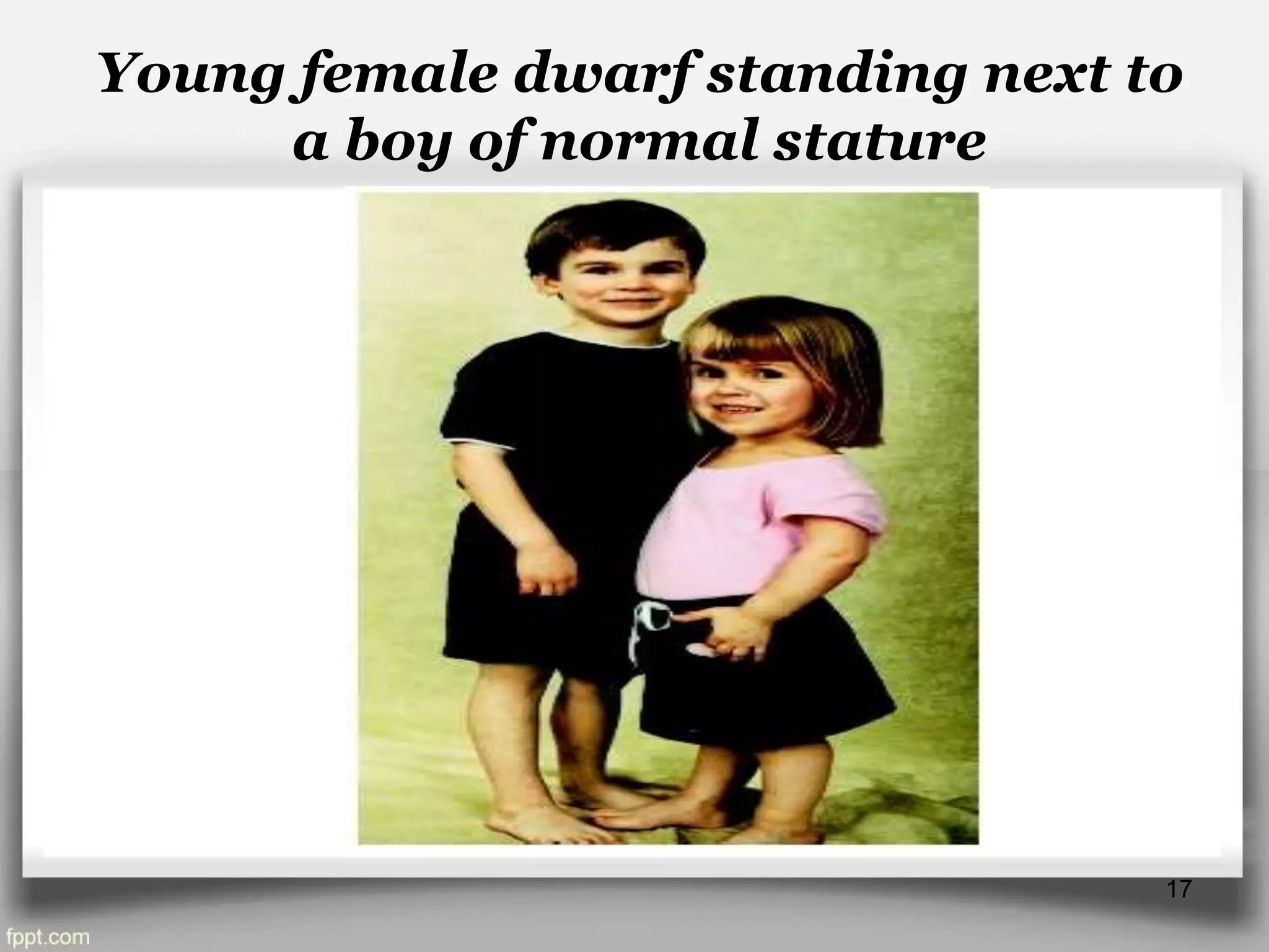 Dwarfism, Gigantism and Acromegaly, Educational Platform.ppt