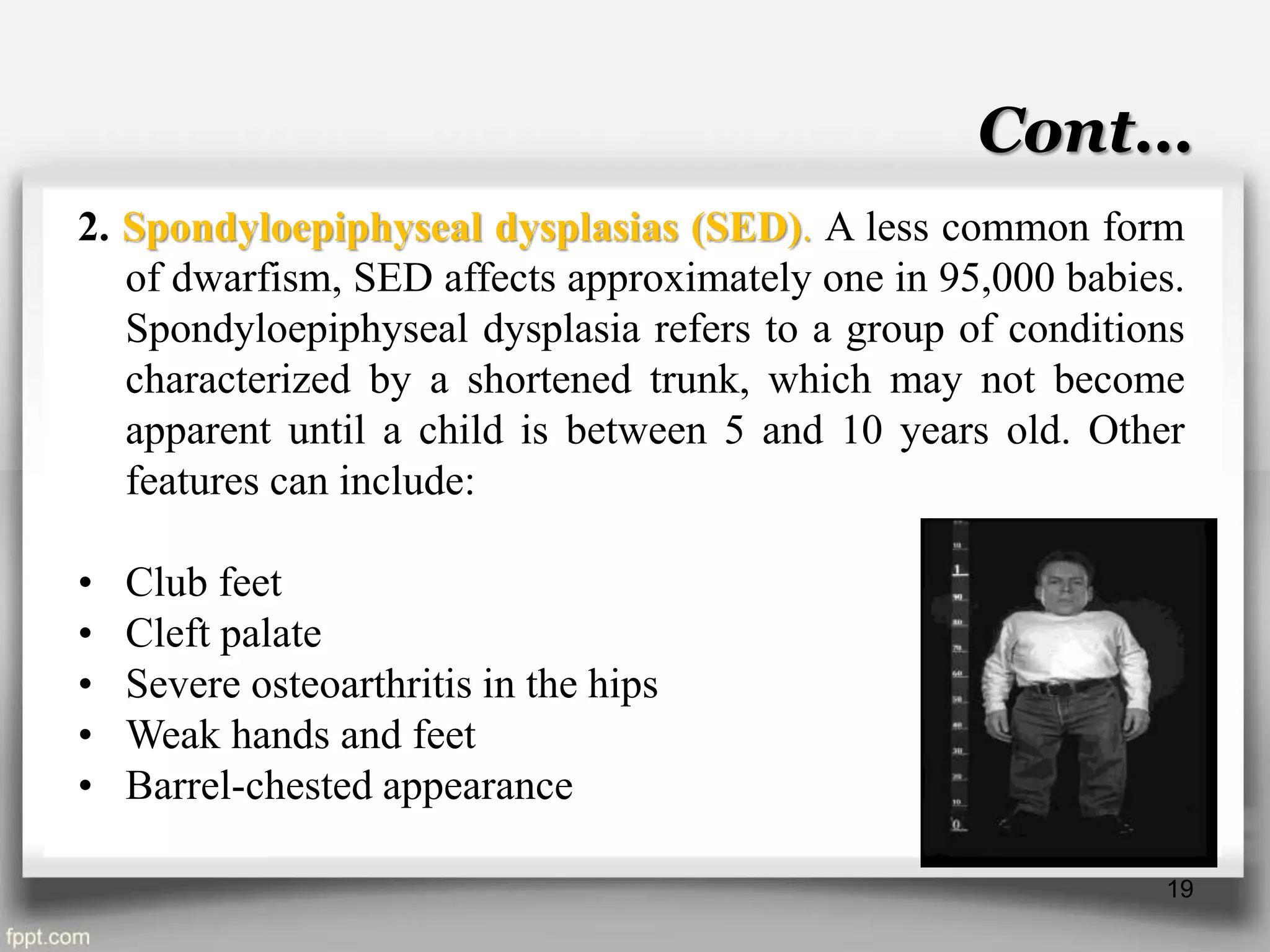 Dwarfism, Gigantism and Acromegaly, Educational Platform.ppt