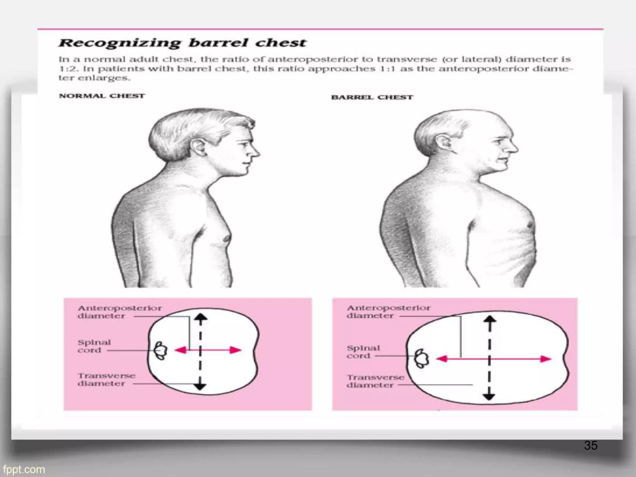 Dwarfism, Gigantism and Acromegaly, Educational Platform.ppt