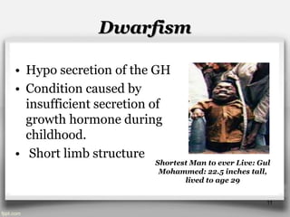 Dwarfism, Gigantism and Acromegaly, Educational Platform.ppt