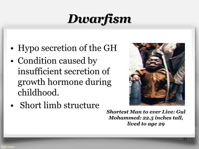 Dwarfism, Gigantism and Acromegaly, Educational Platform.ppt ...