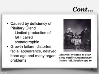 Dwarfism, Gigantism and Acromegaly, Educational Platform.ppt