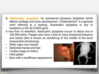 Dwarfism, Gigantism and Acromegaly, Educational Platform.ppt
