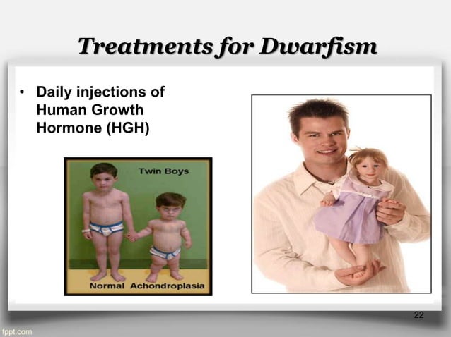 Dwarfism, Gigantism and Acromegaly, Educational Platform.ppt ...