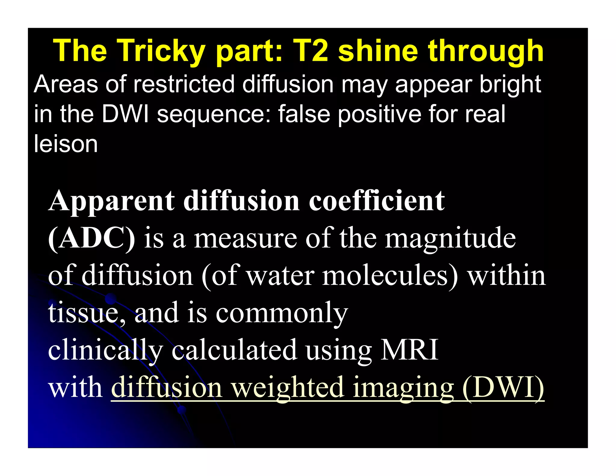 DWI/ ADC -MRI principles in veterinary medicine | PDF