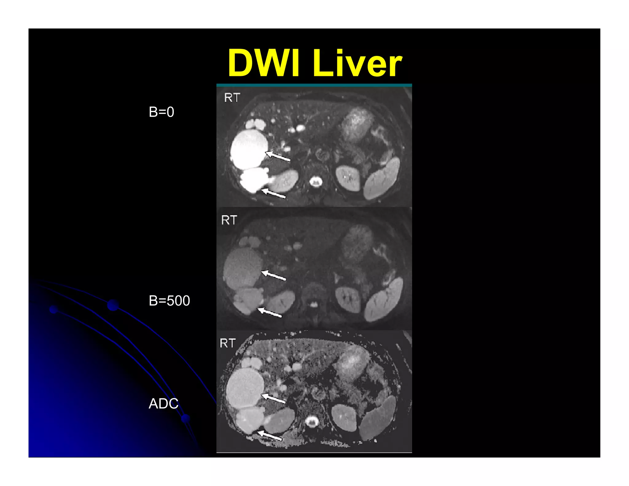 DWI/ ADC -MRI principles in veterinary medicine | PDF