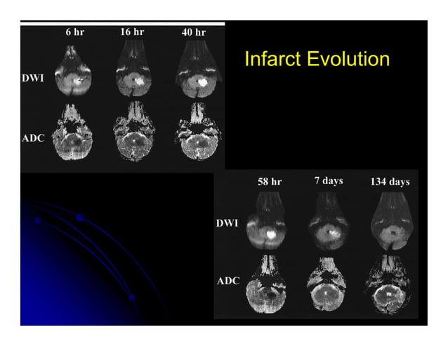 DWI/ ADC -MRI principles in veterinary medicine | PPT