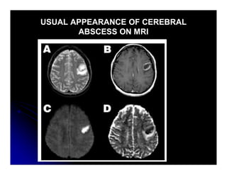DWI/ ADC -MRI principles in veterinary medicine | PDF