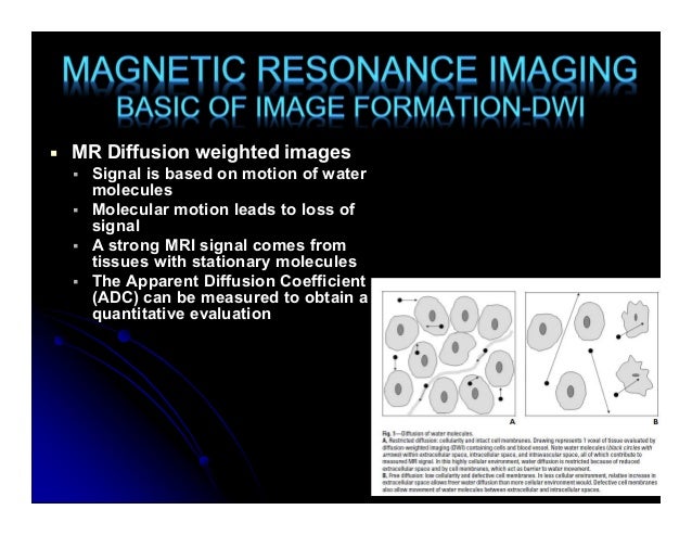DWI/ ADC -MRI principles in veterinary medicine