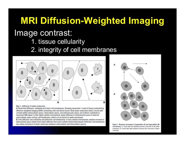 DWI/ ADC -MRI principles in veterinary medicine