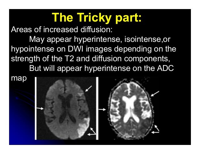 DWI/ ADC -MRI principles in veterinary medicine