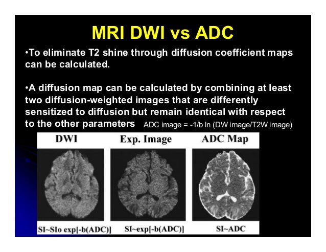 DWI/ ADC -MRI principles in veterinary medicine