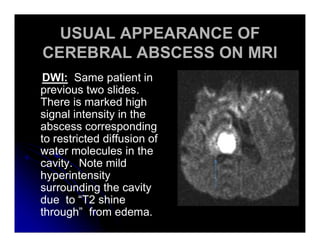 DWI/ ADC MRI principles/ applications in veterinary medicine | PDF