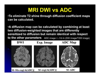 DWI/ ADC MRI principles/ applications in veterinary medicine | PPT