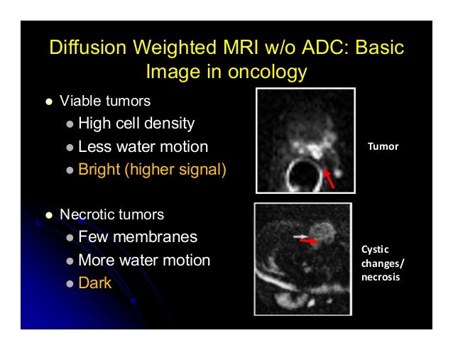 DWI/ ADC MRI principles/ applications in veterinary medicine