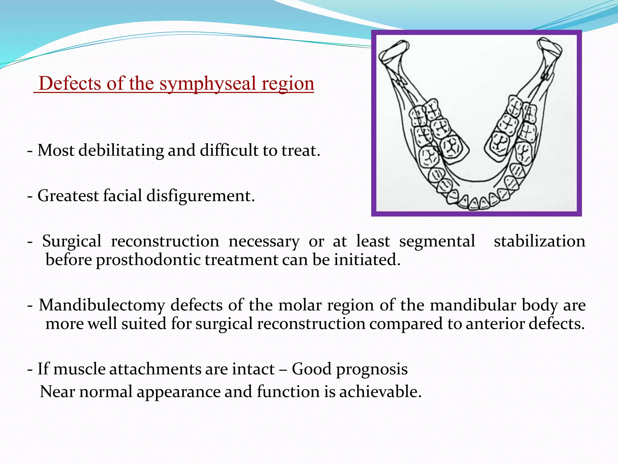 Management of aquired mandibular defect / mandible defect management | PPTX