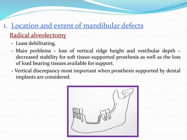 Management of aquired mandibular defect / mandible defect management | PPTX