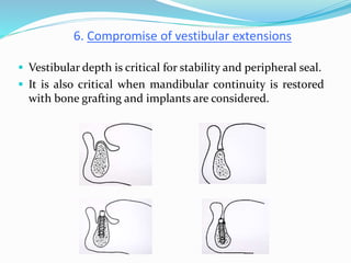 Management of aquired mandibular defect / mandible defect management | PPTX