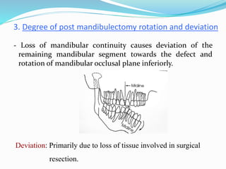 Management of aquired mandibular defect / mandible defect management | PPT