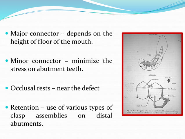 Management of aquired mandibular defect / mandible defect management