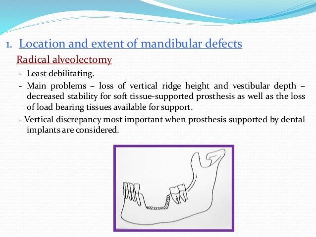 Management of aquired mandibular defect / mandible defect management